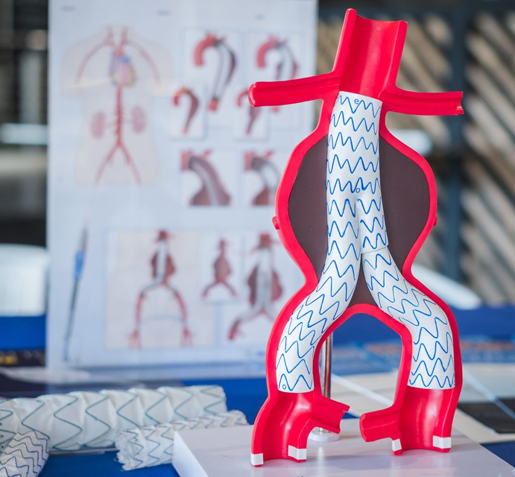 Vascular Surgeons in Dubai | Best Vascular Surgeons in Dubai