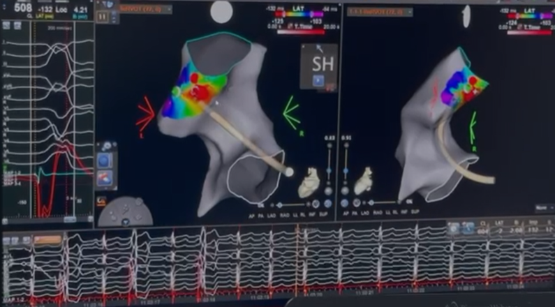 Electrophysiologist in Dubai | Electrophysiology Clinic EHG