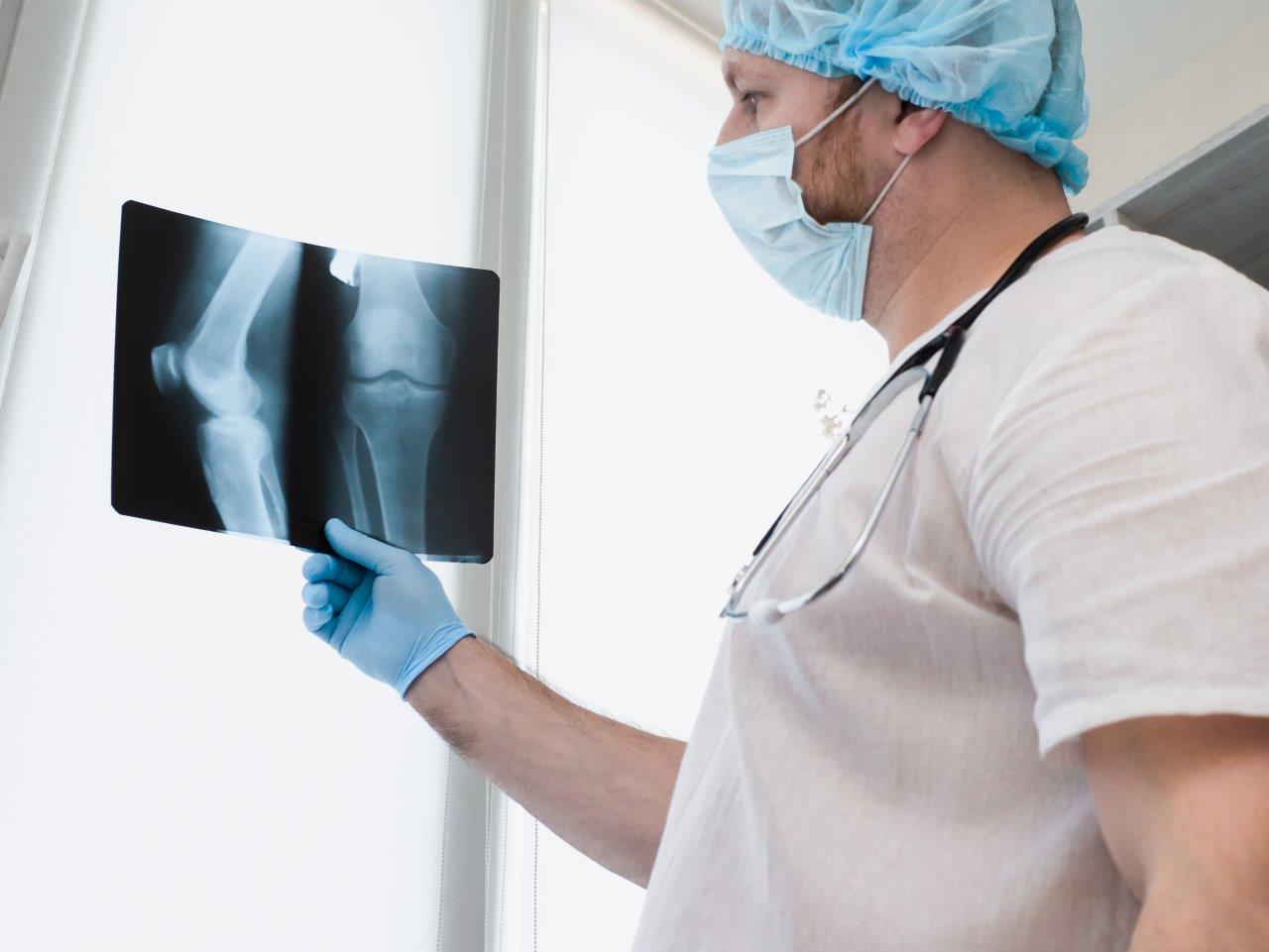 Partial Knee Replacement in Dubai | Best Orthopedic Surgeons