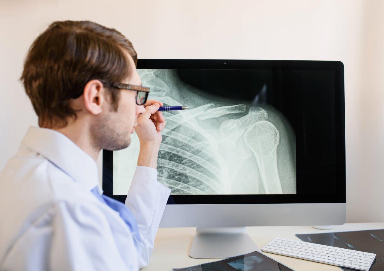 Best Clavicle Fracture Treatment | Collarbone Fracture