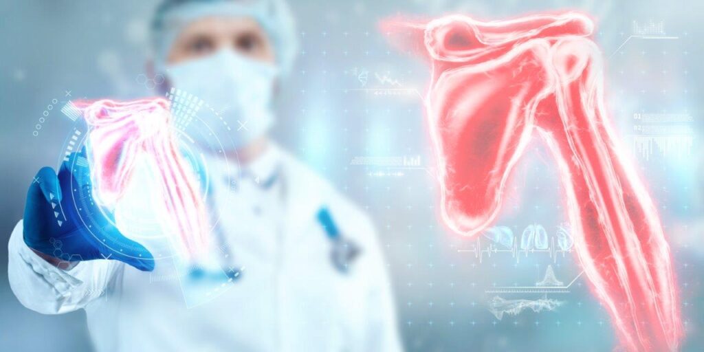 Dislocated Shoulder Treatment | Best Orthopedic Surgeons