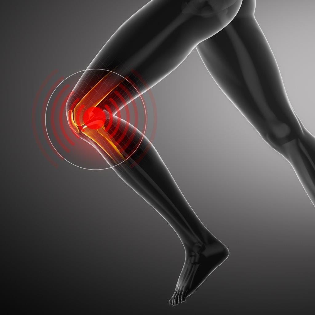 Best PCL Tear Treatment | Posterior Cruciate Ligament Injury