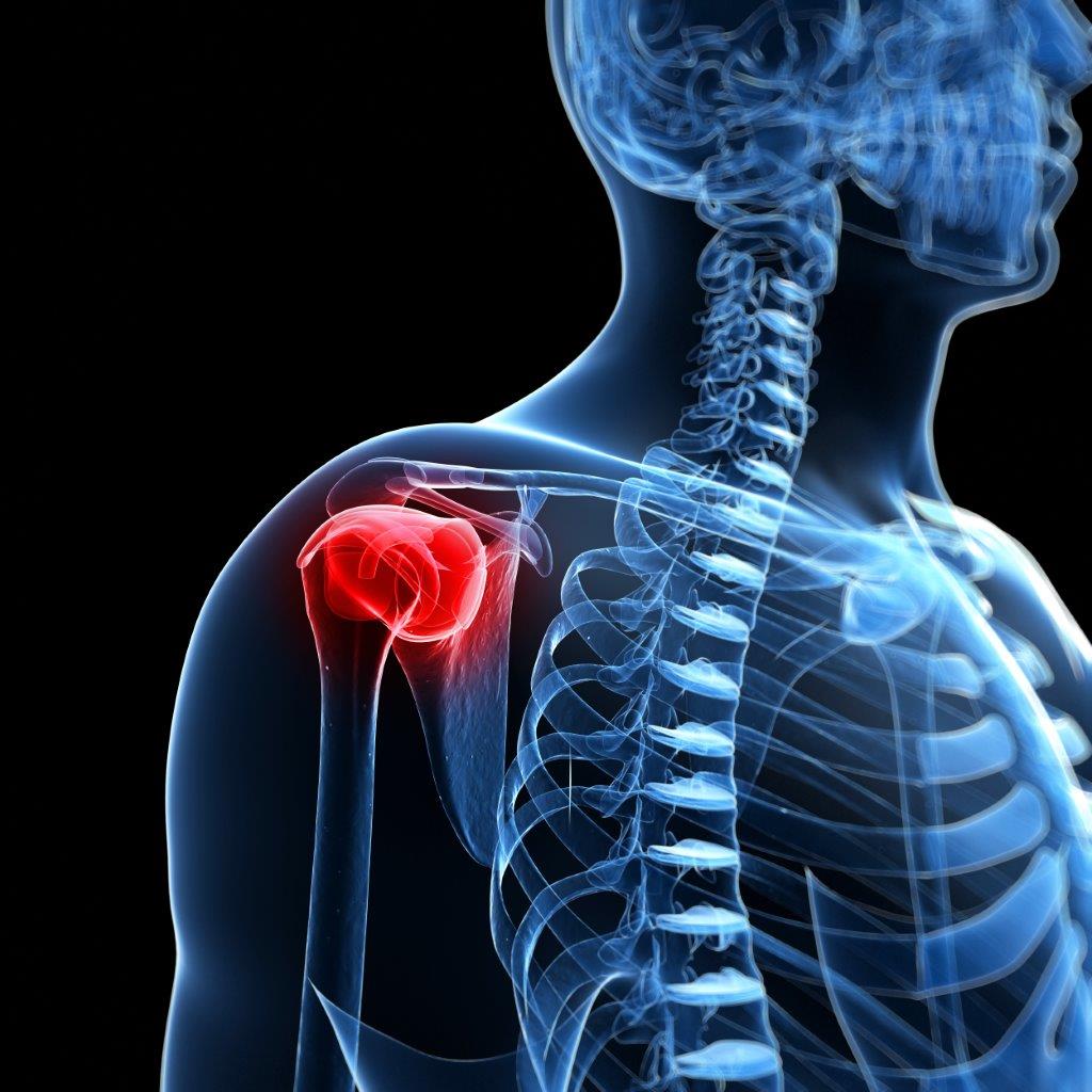 SLAP Tear Shoulder Surgery | Best Orthopedic Surgeons