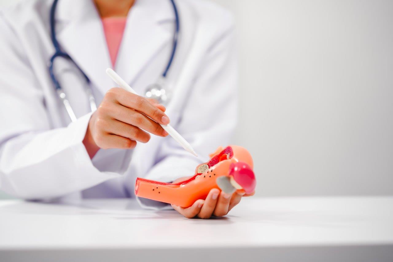 Hysteroscopic Myomectomy | Best Fibroid Removal Surgery