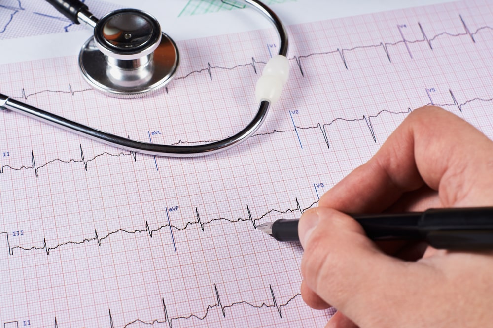 Electrocardiogram (ECG) Test in Dubai at Emirates Hospitals