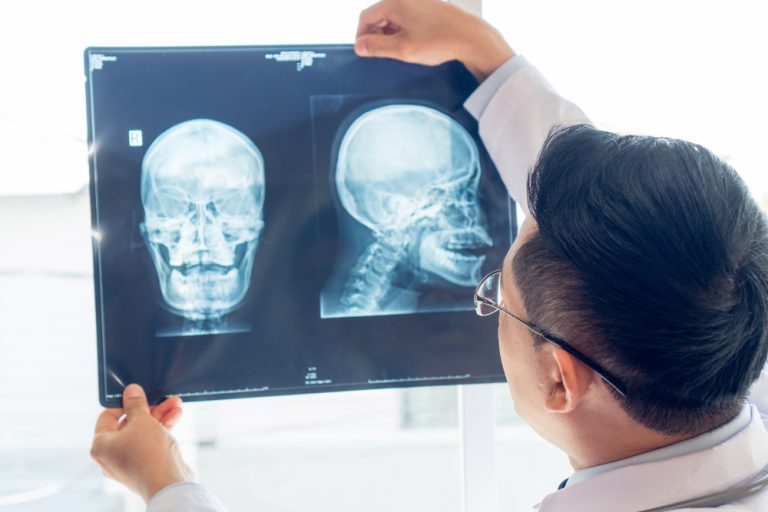 Head and Neck Surgery in Dubai | Emirates Hospitals Group