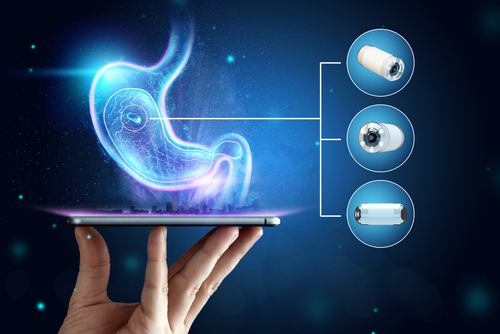 Capsule Endoscopy Package at Emirates Hospitals