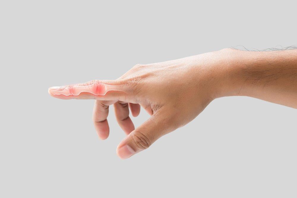 Finger Fracture Treatment | Best Hand & Wrist Surgeons