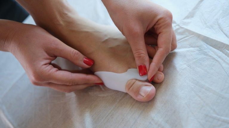 Toe Deformity Treatment | Best Doctors For Toe Deformity