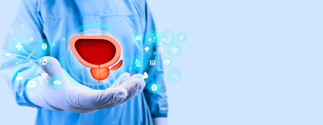 Prostate Cancer Treatment | Best Urology Clinic