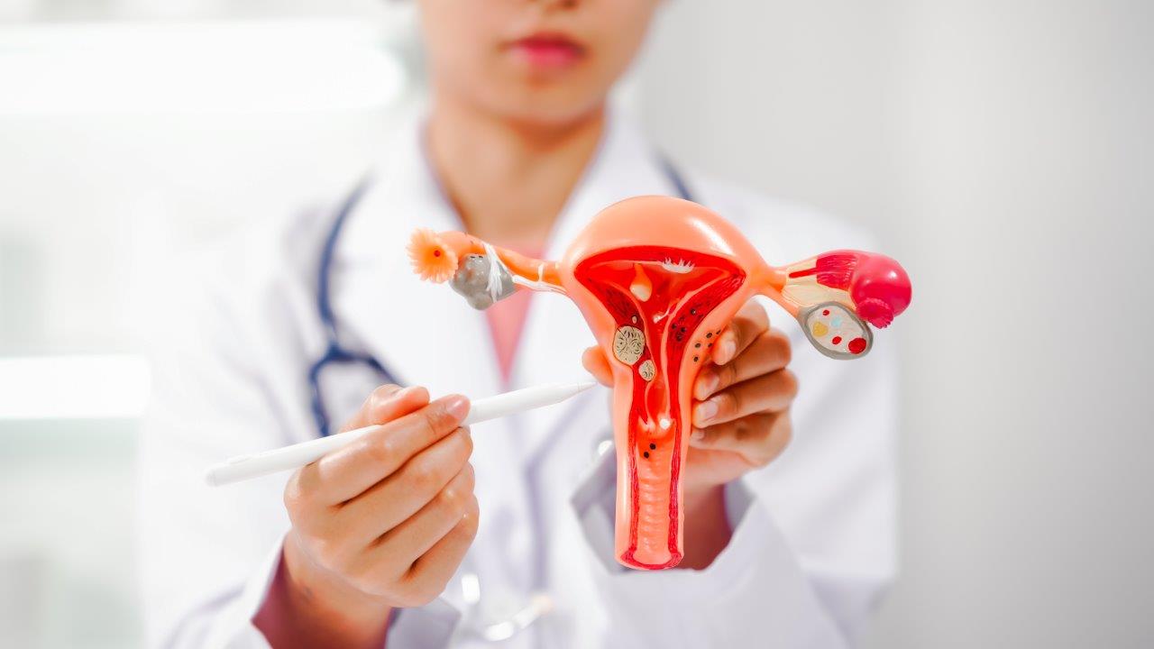 Gynecologic Cancer | Cancer Treatment in Dubai