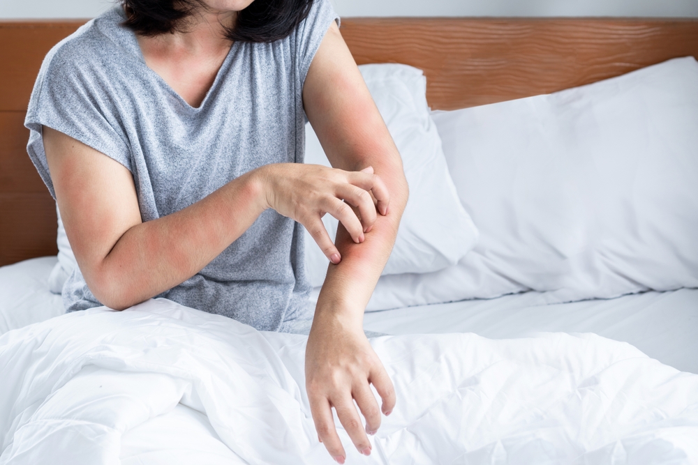 Itching and Irritation – Causes, Diagnosis & Treatment Dubai