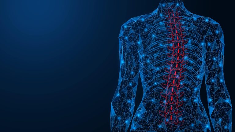 Vertebral Body Tethering (VBT) Scoliosis Surgery in Dubai UAE