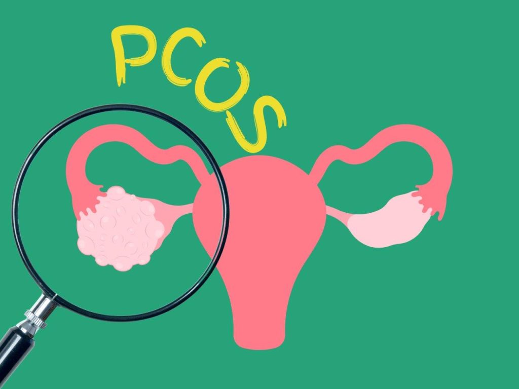 PCOS Nutrition Guidelines - Emirates Hospitals